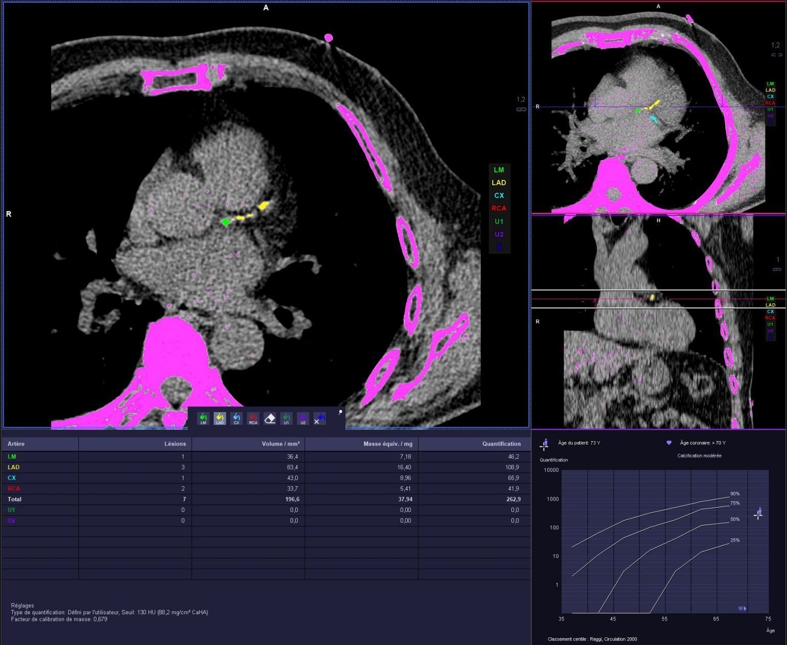 Bilan Cardiologique - Médecine Nucléaire - CHPG